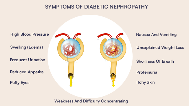 Diabetic Nephropathy Diet : Let’s Learn More For Wellness - Fitelo